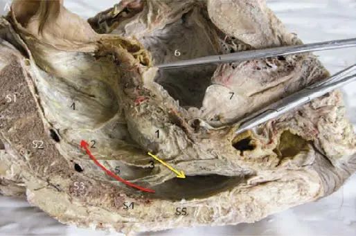 TaTME技术要点_直肠癌_直肠癌治疗方式 - 好大夫在线
