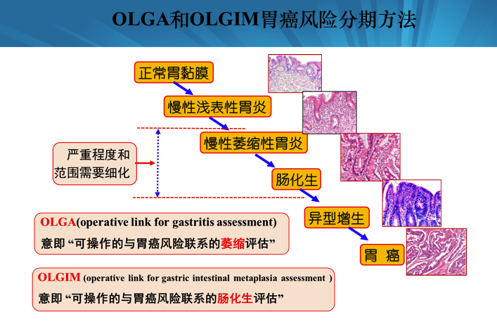 慢性胃炎OLGA、OLGIM分期以及随访流程 - 好大夫在线